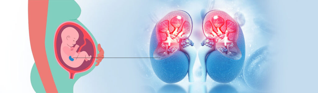 Kidney Swelling in unborn babies : Expert Advice
